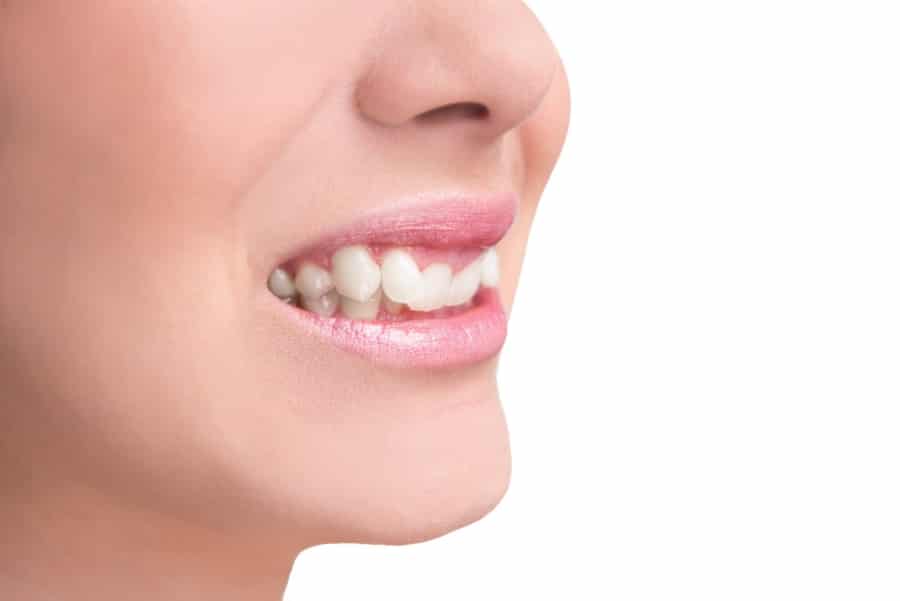 Correcting Bad Bites with Surgical Treatment